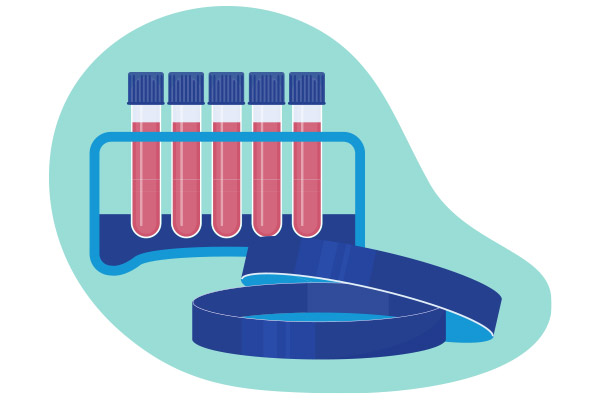 Blood Culture Collection Best Practices for Laboratory Professionals ...