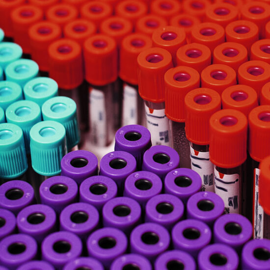 Blood Culture Collection Best Practices for Laboratory Professionals ...